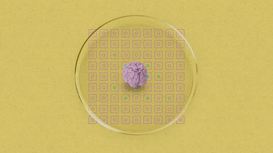 Ren Ecosystem. Human brain cells hooked up to a chip can do speech ...